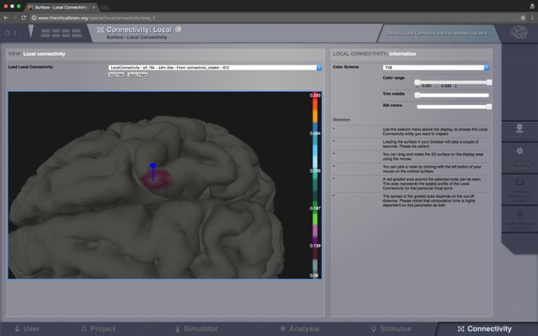 The Virtual Brain: Delivering practical results. For novel clinical ...